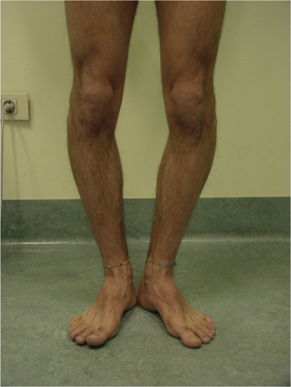 Esempi di casi clinici – Kirienko